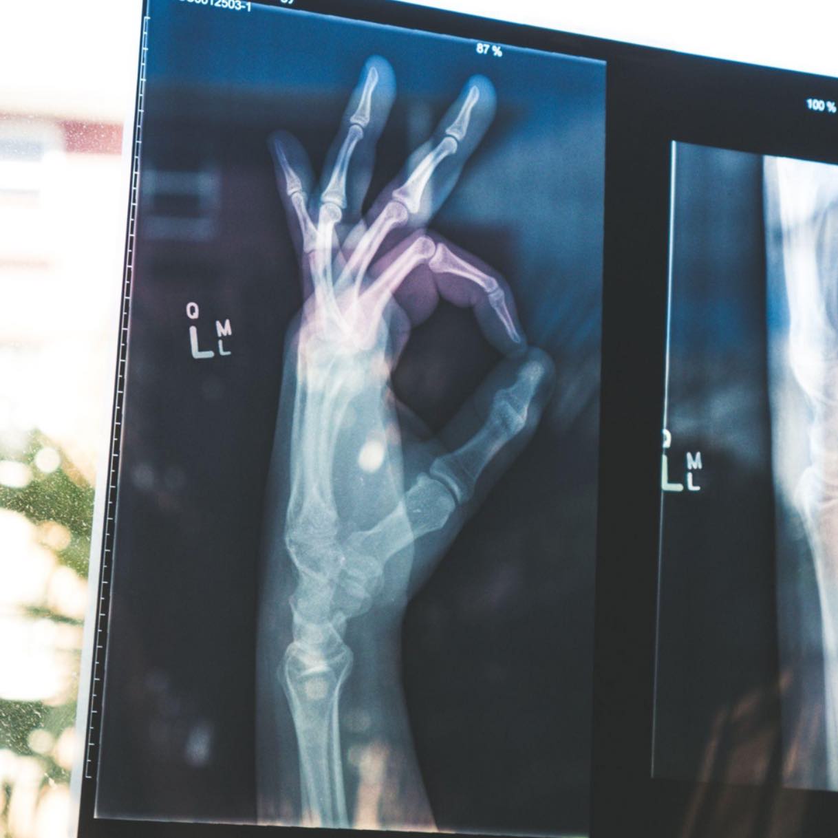 Benefits Of A Mushroom Stack Supplement